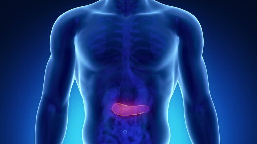 Types of Pancreatic Cancer | Roswell Park Comprehensive Cancer Center ... Types of Pancreatic Cancer | Roswell Park Comprehensive Cancer Center ...