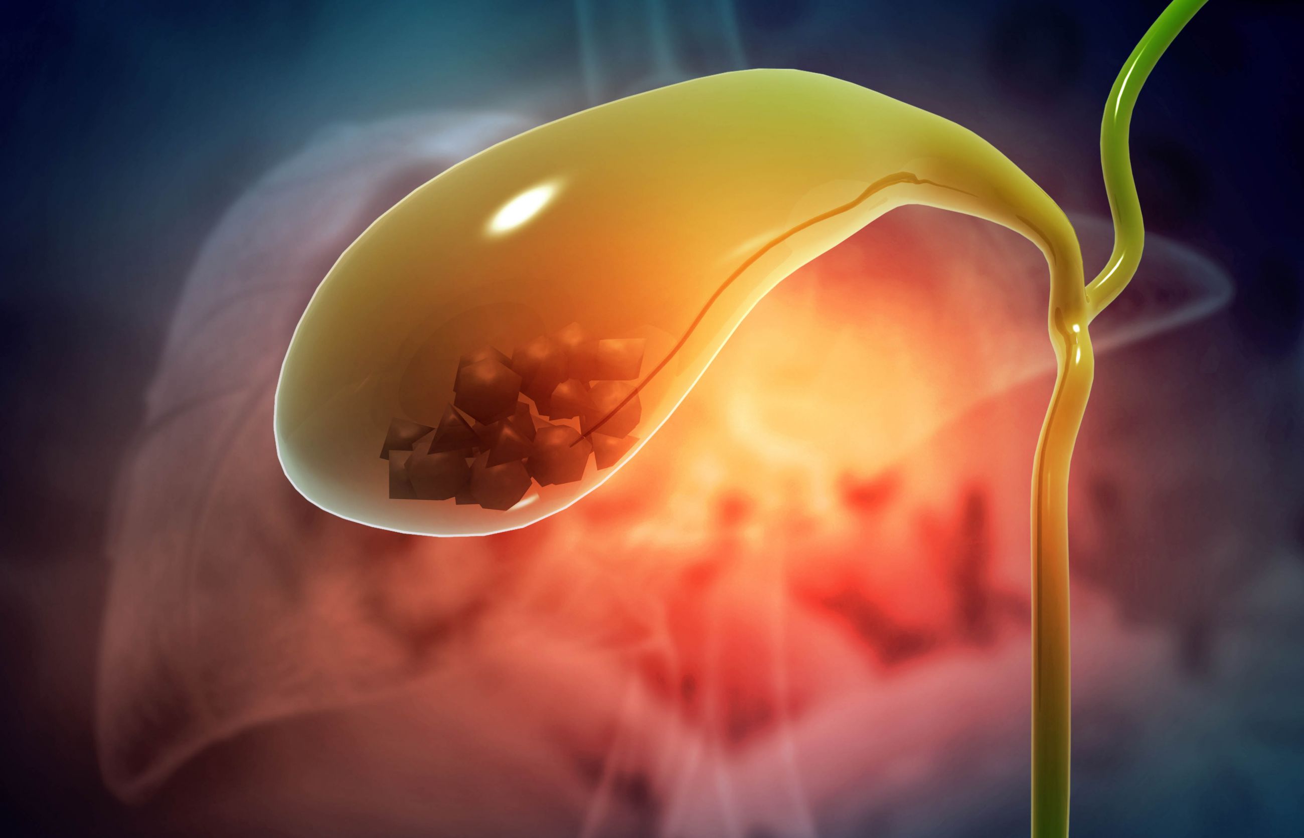 Images Of Bladder Cancer Tumors Images Of Bladder Cancer Tumors