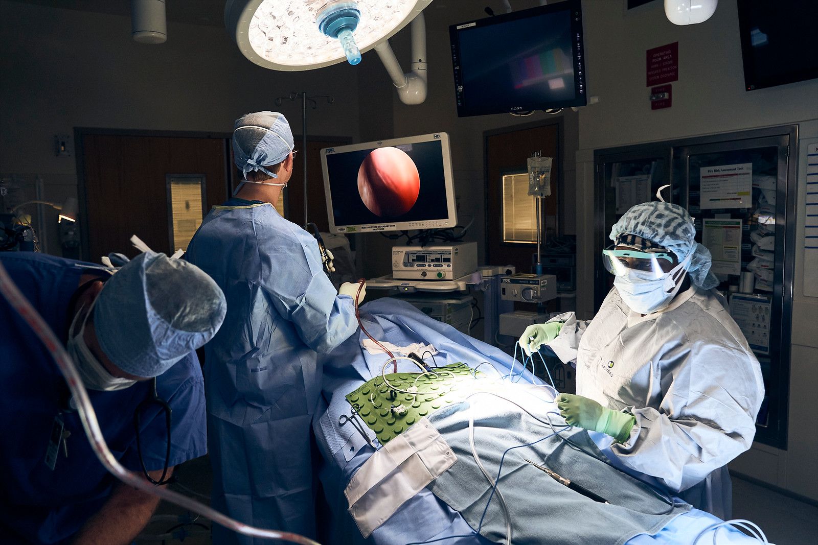 Surgery for Head & Neck Cancers | Roswell Park Comprehensive Cancer ...