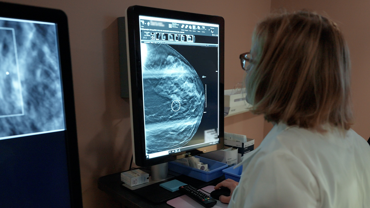 Getting a breast biopsy — what to expect | Roswell Park Comprehensive ...