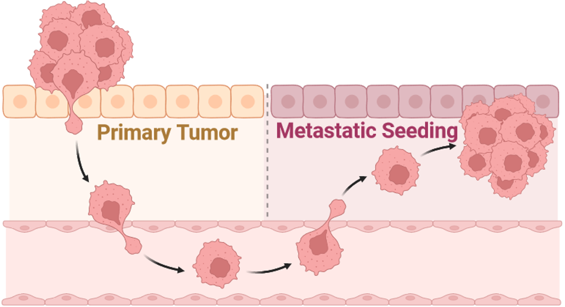 Ebos Lab Research: Metastasis | Roswell Park Comprehensive Cancer ...
