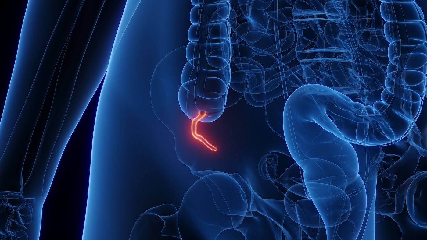 Can you get cancer in your appendix? | Roswell Park Comprehensive ...