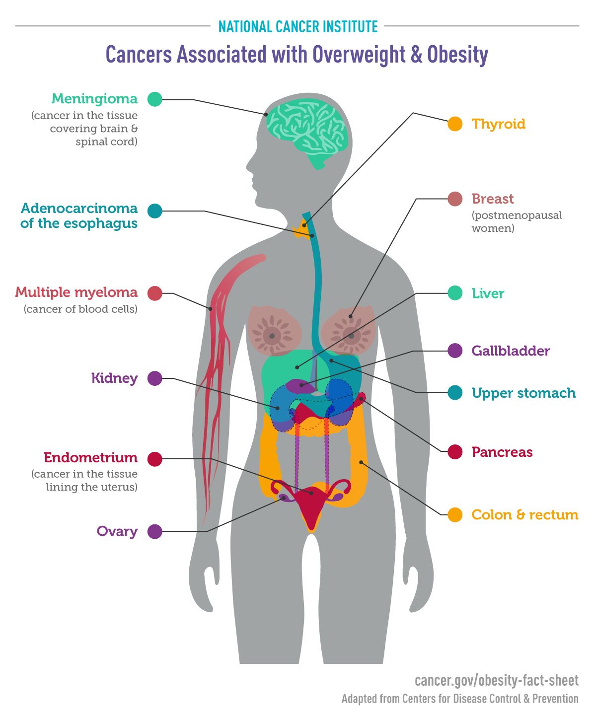 CANCER CRISIS: Overweight & Obesity on Track to Cause More Cancers than ...