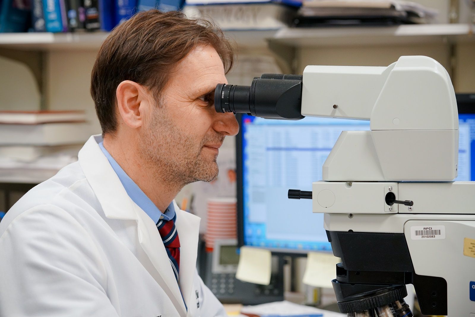 Prostate Cancer Pathology Roswell Park Comprehensive Cancer Center prostate-cancer-pathology-roswell-park-comprehensive-cancer-center