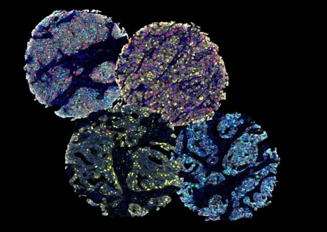Roswell Park Researchers Reveal Promising New Approach to Cancer ...