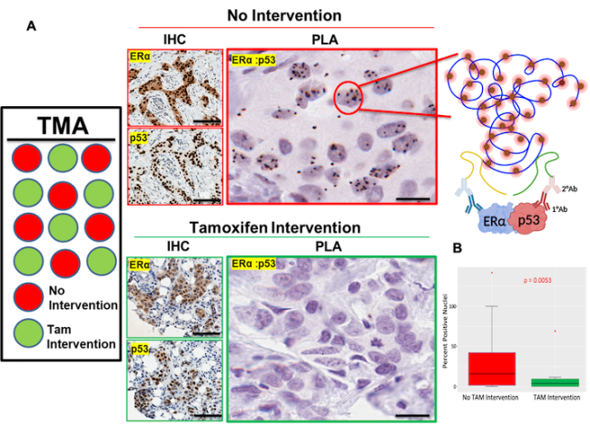 Das Lab Research: Luminal Breast Cancer | Roswell Park Comprehensive ...