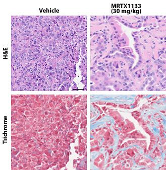 Witkiewicz-Knudsen Lab Research: Therapeutically Targeting Pancreatic ...