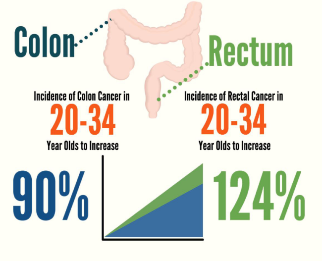 5 things young people should know about colorectal cancer | Roswell ...